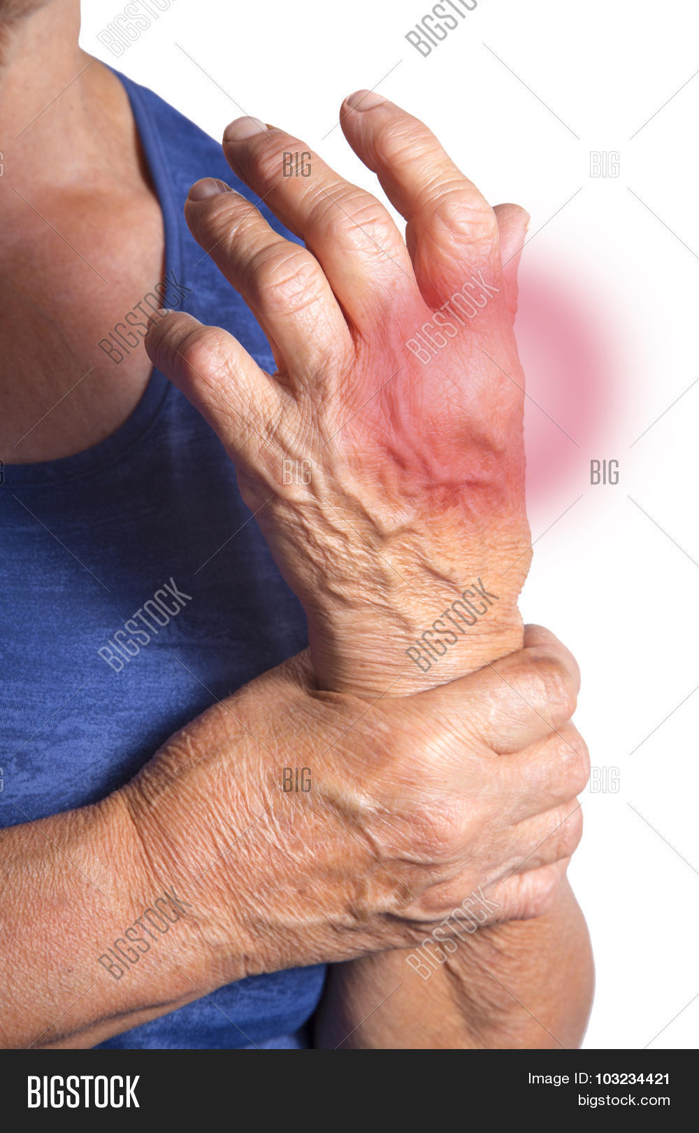 Hand Deformed Image & Photo (Free Trial) | Bigstock