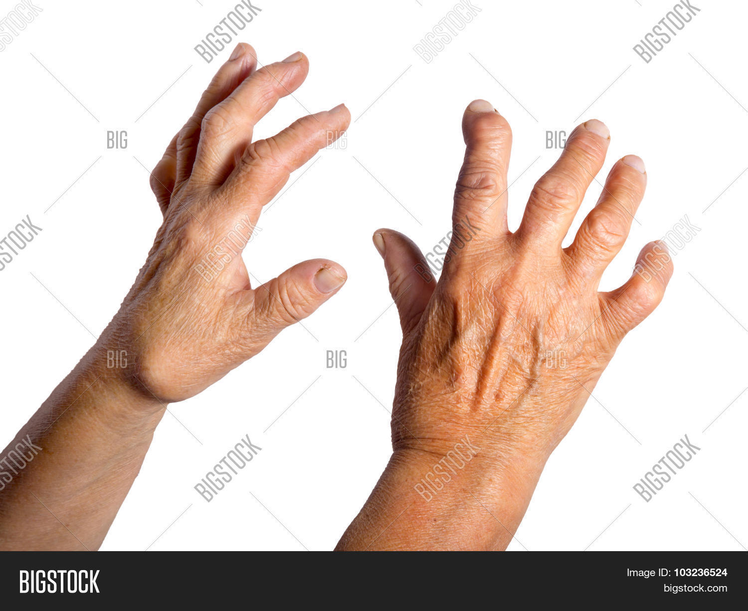 Hand Deformed Image & Photo (Free Trial) | Bigstock