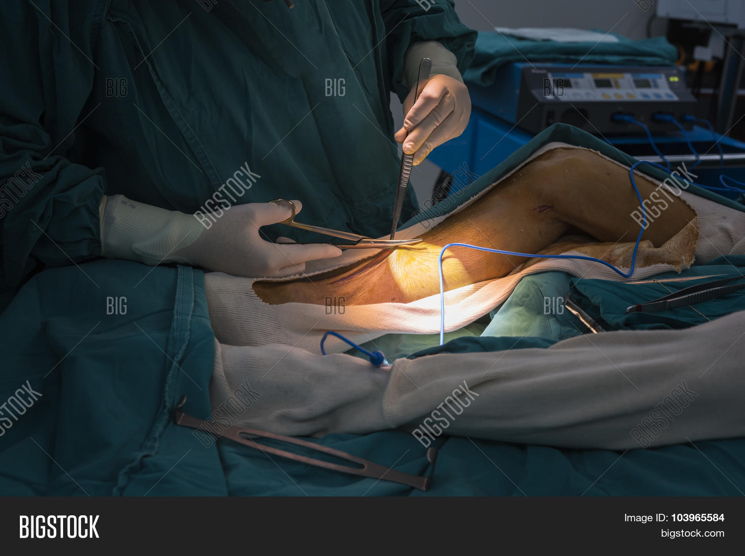 Greater Saphenous Vein Image & Photo (Free Trial) | Bigstock