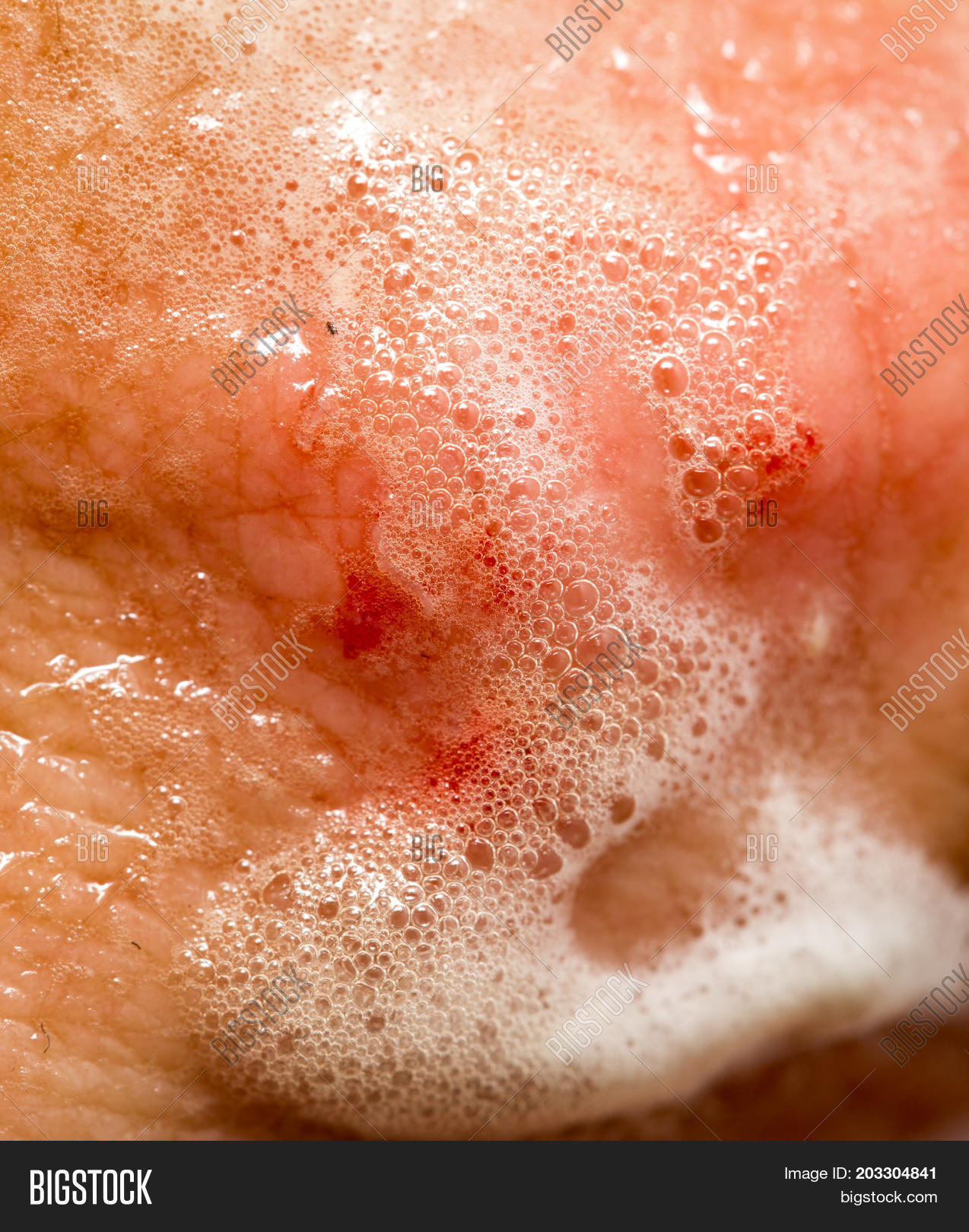 Blood On Skin Cut Image & Photo (Free Trial) | Bigstock
