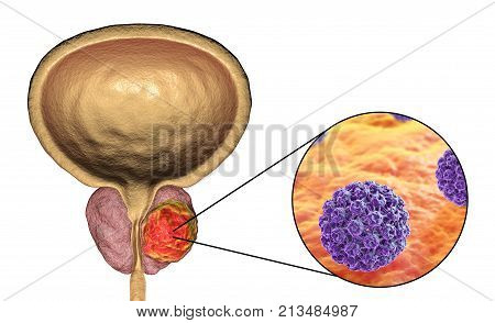 Conceptual Image Viral Image & Photo (Free Trial) | Bigstock