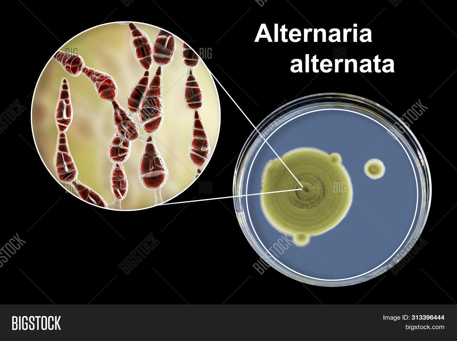 Imagen y foto Mold Alternaria (prueba gratis) | Bigstock