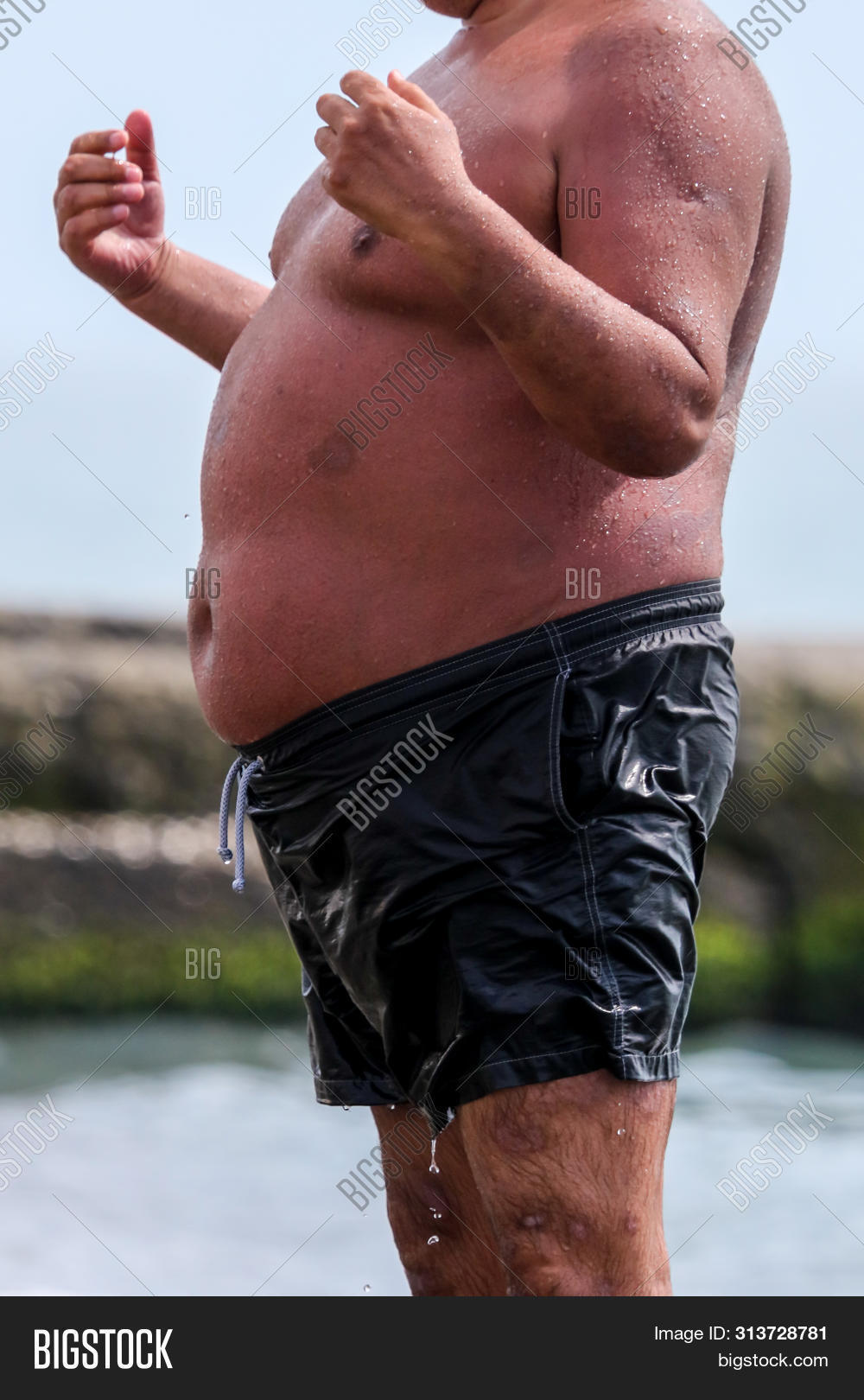 Fat Man Burned Sun. Image & Photo (Free Trial) | Bigstock