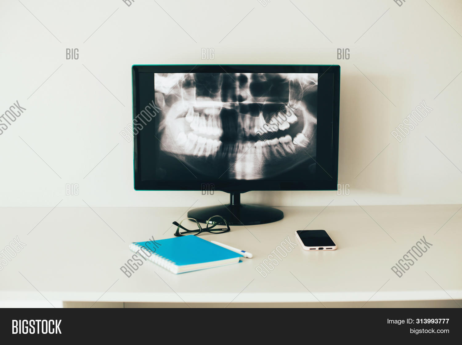 X-ray On Monitor Image & Photo (Free Trial) | Bigstock