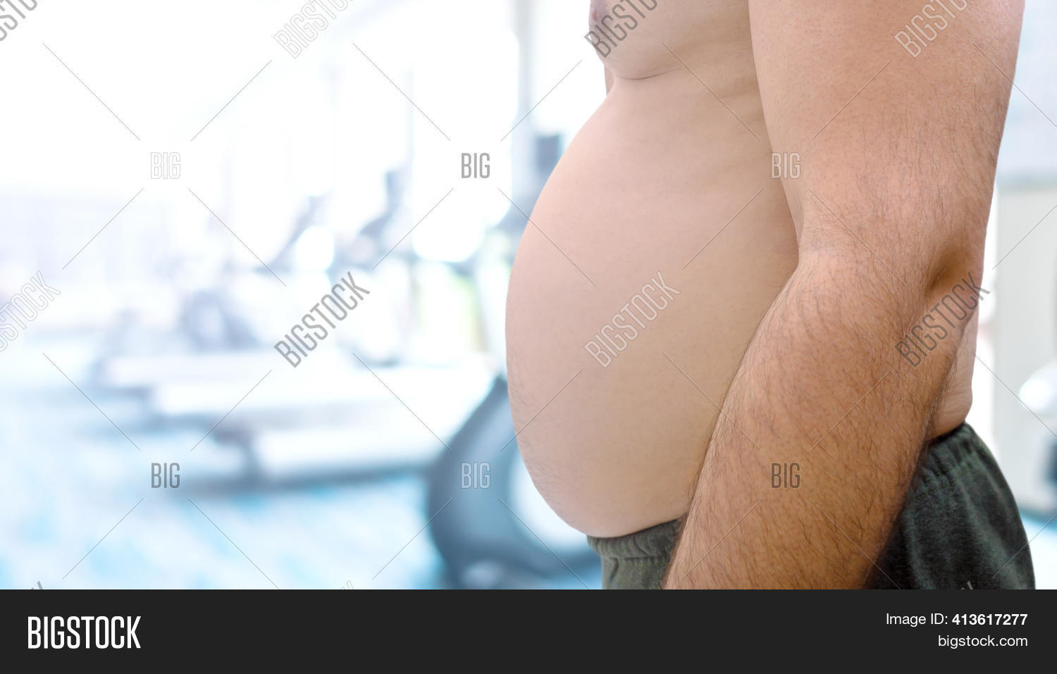 Obese Man Excessive Image & Photo (Free Trial) | Bigstock