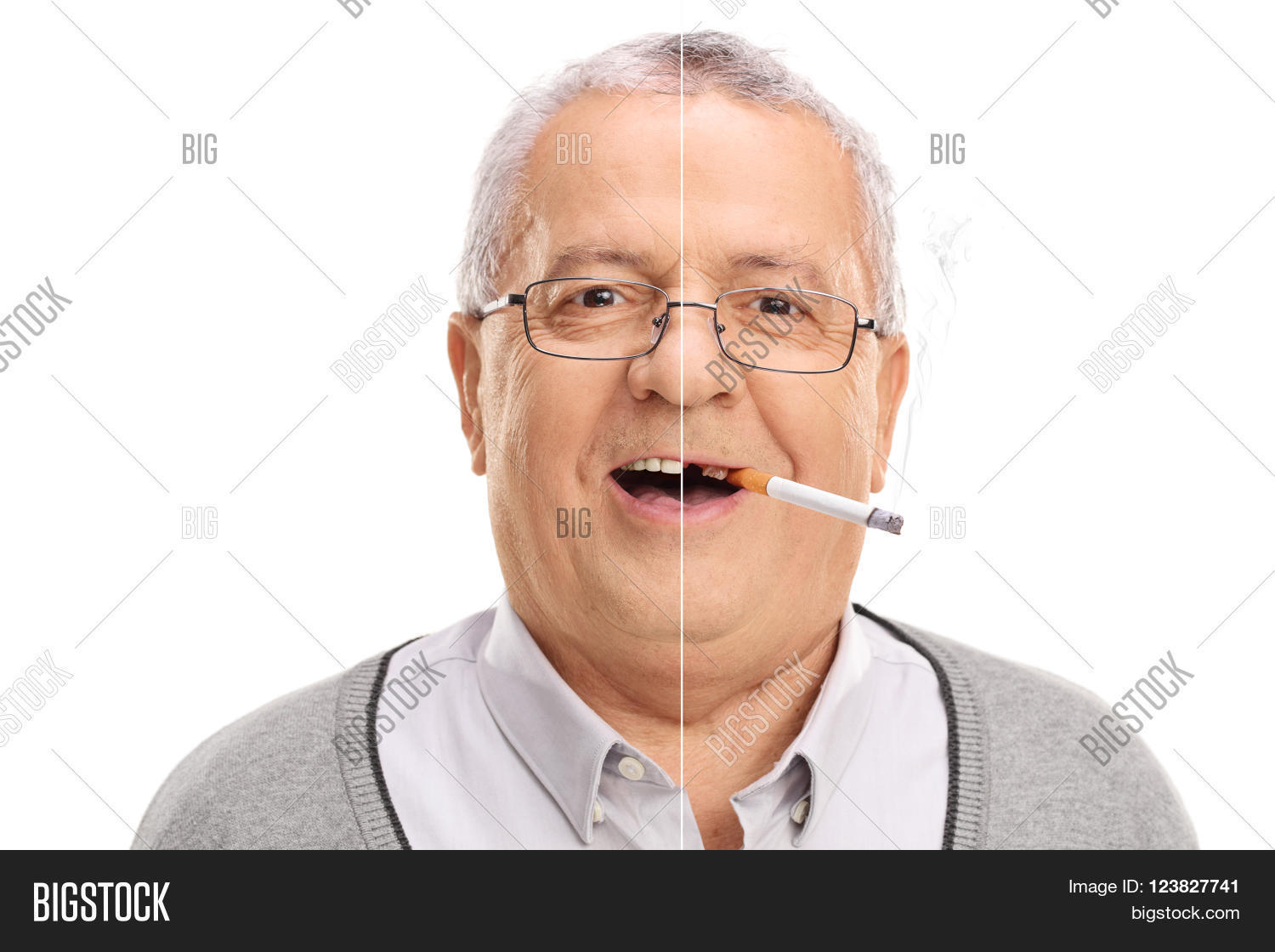 Before After Smoking Image & Photo (Free Trial) | Bigstock
