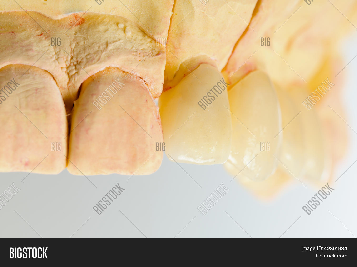 Pressed Ceramic Teeth Image & Photo (Free Trial) | Bigstock
