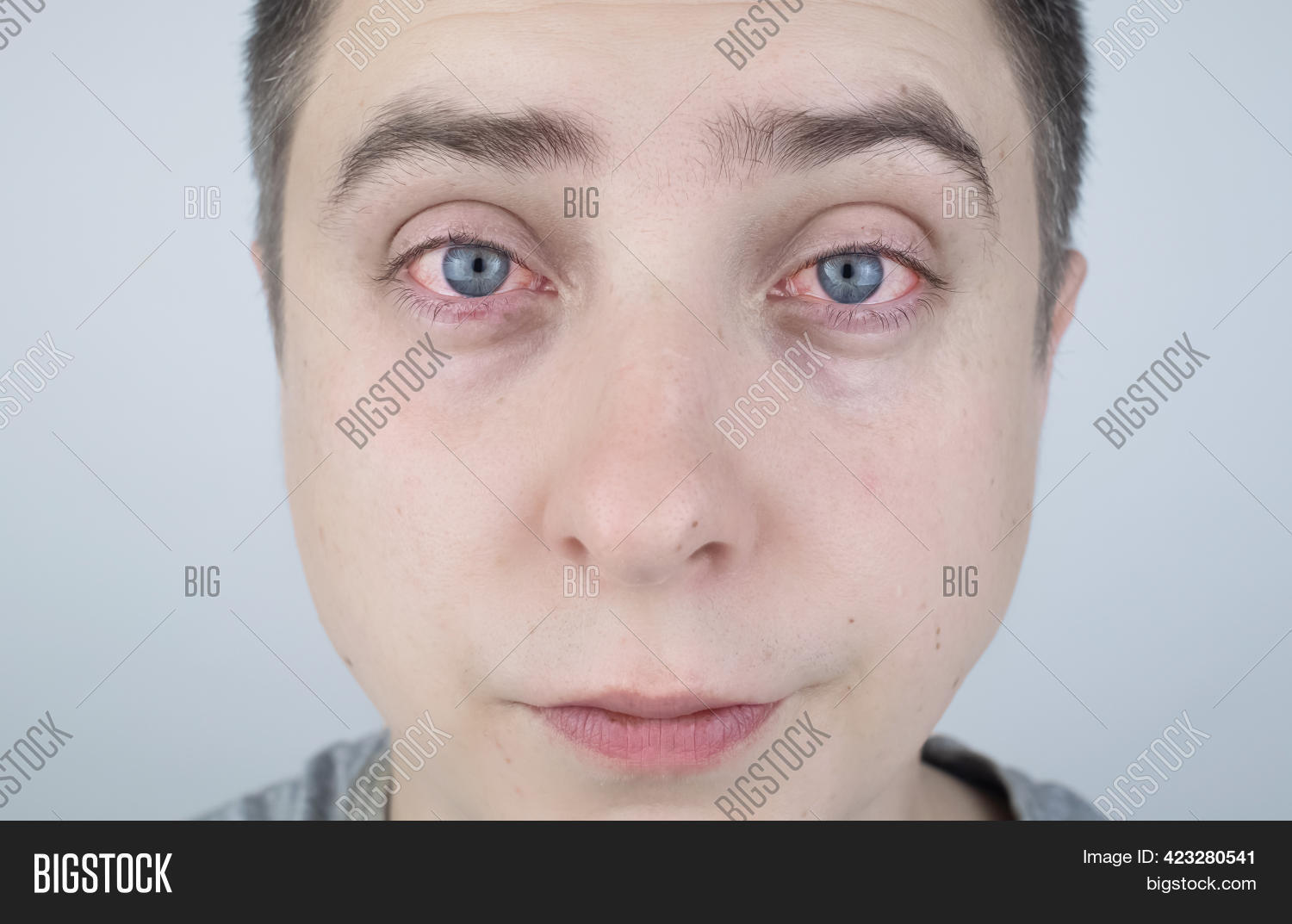 Close Two Annoyed Red Image & Photo (Free Trial) | Bigstock
