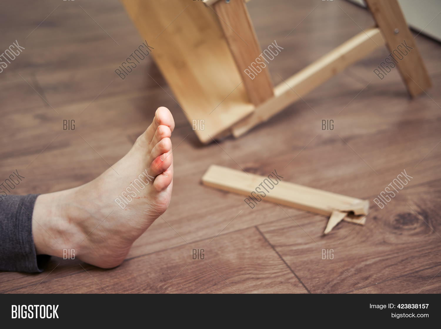 Man Injured His Toe Image & Photo (Free Trial) | Bigstock