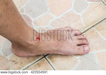 Injuries Falling Image & Photo (Free Trial) | Bigstock