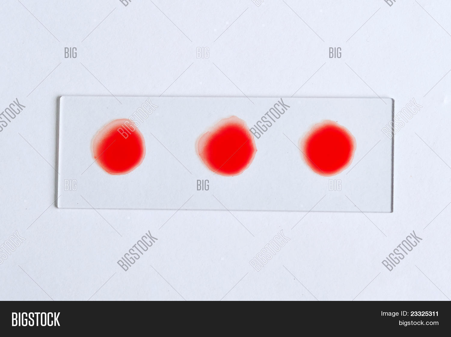 Blood Slide Image & Photo (Free Trial) | Bigstock