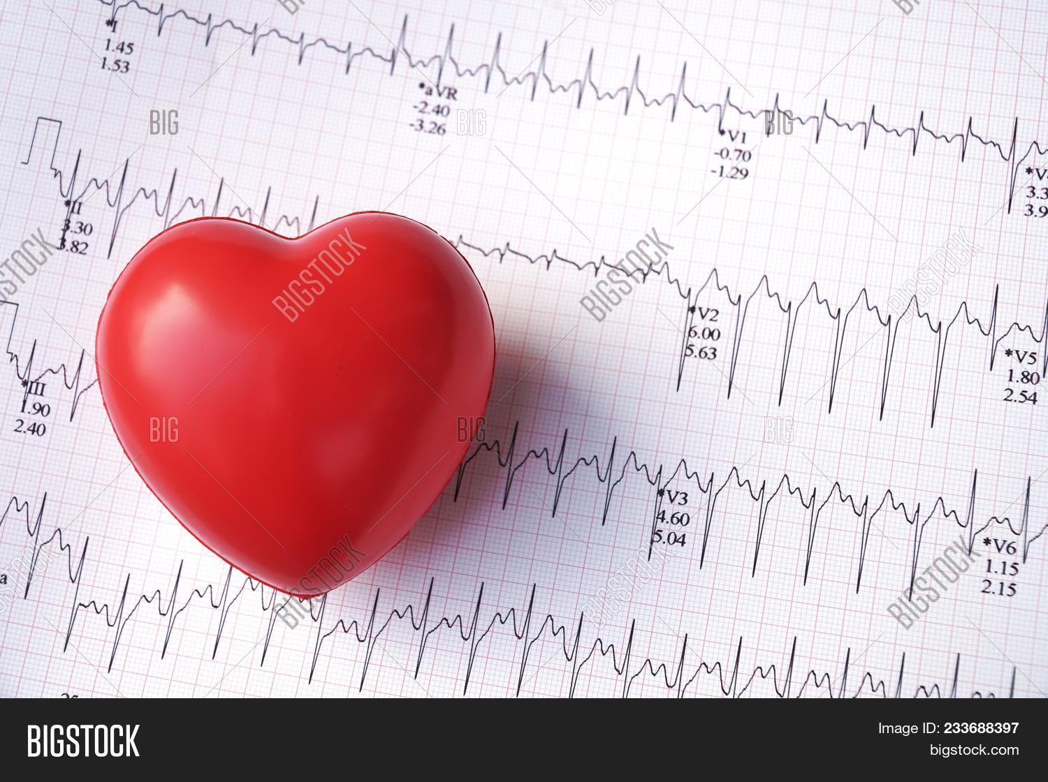 Heart Pulse Graphic Image & Photo (Free Trial) | Bigstock