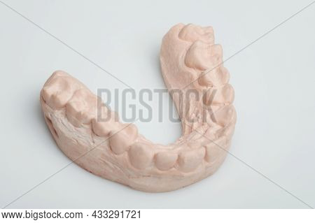 Model Human Jaw Image & Photo (Free Trial) | Bigstock