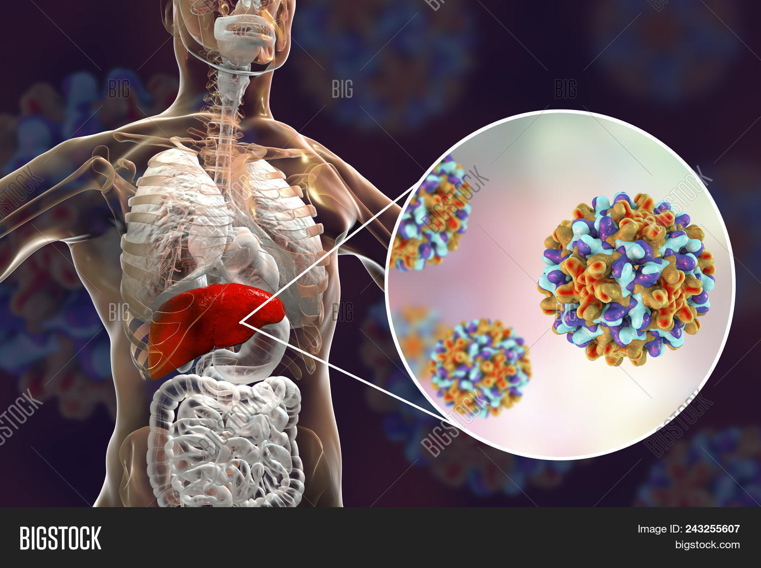 Liver Hepatitis B Image & Photo (Free Trial) | Bigstock