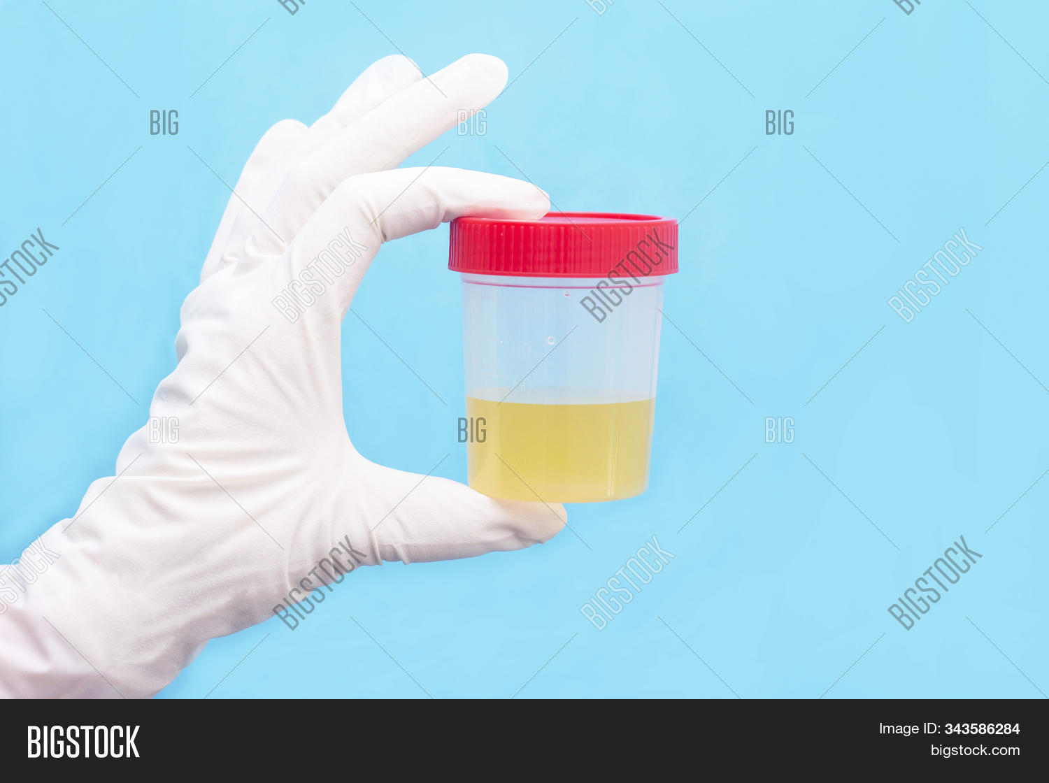 Medical Analysis Urine Image & Photo (Free Trial) | Bigstock
