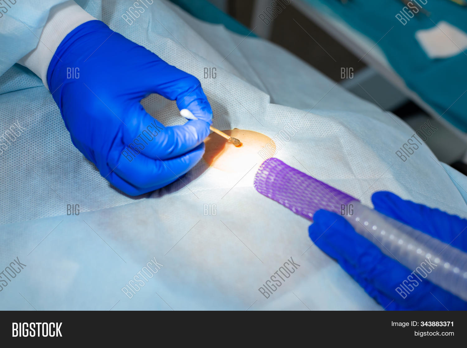Close- Surgeon Burns Image & Photo (Free Trial) | Bigstock