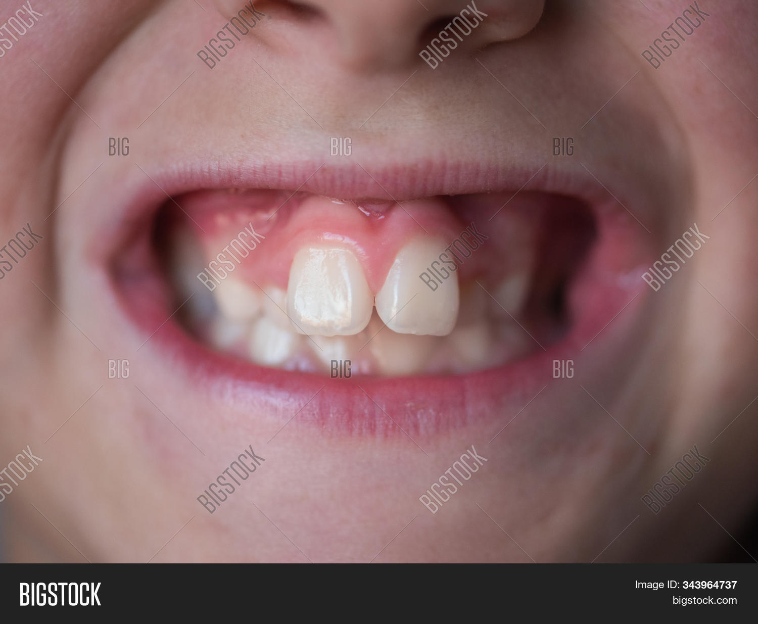 Problems Teeth Young Image & Photo (Free Trial) | Bigstock
