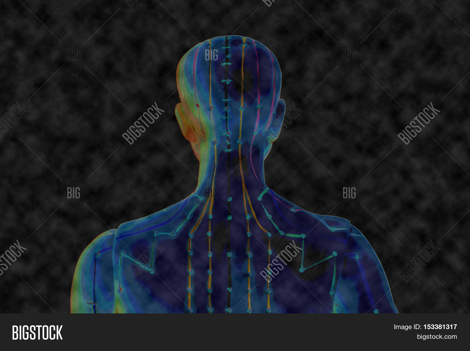 Medical Acupuncture Image & Photo (Free Trial) | Bigstock