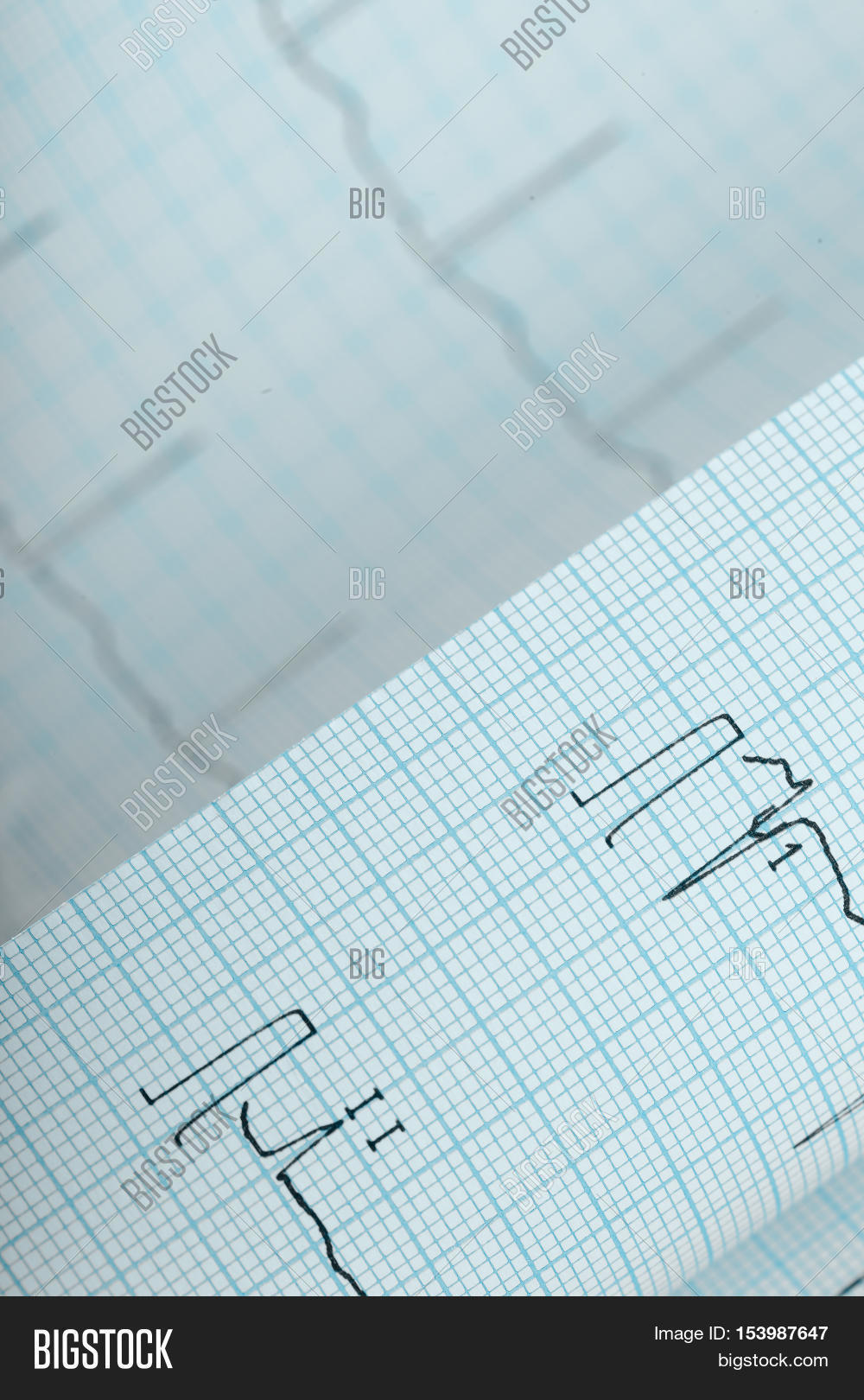 ECG Chart Folded Paper Image & Photo (Free Trial) | Bigstock