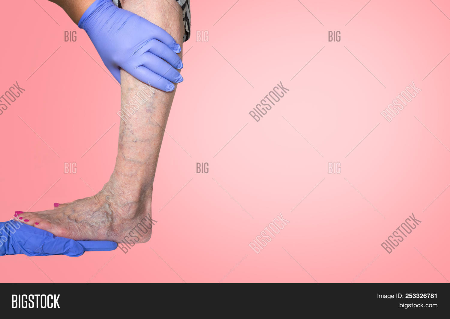 Lower Limb Vascular Image & Photo (Free Trial) | Bigstock