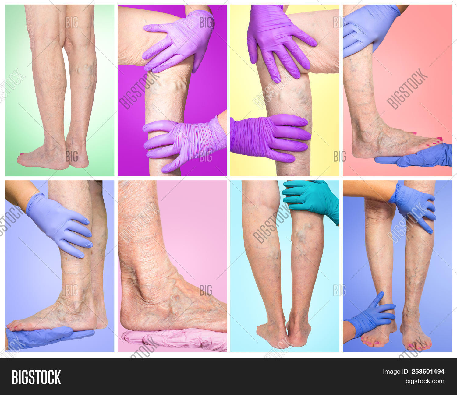 Lower Limb Vascular Image & Photo (Free Trial) | Bigstock