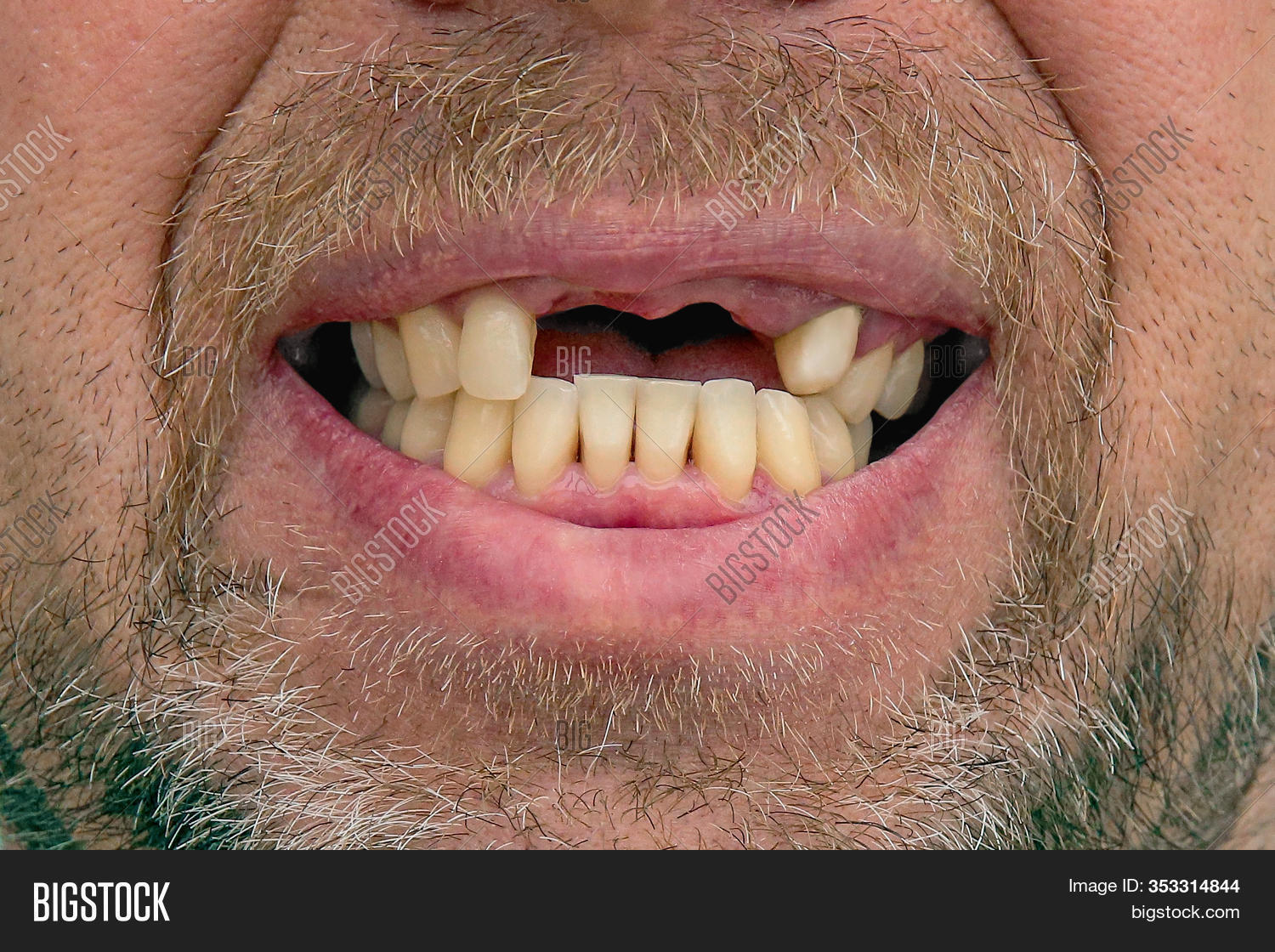 Smile Teeth Guy