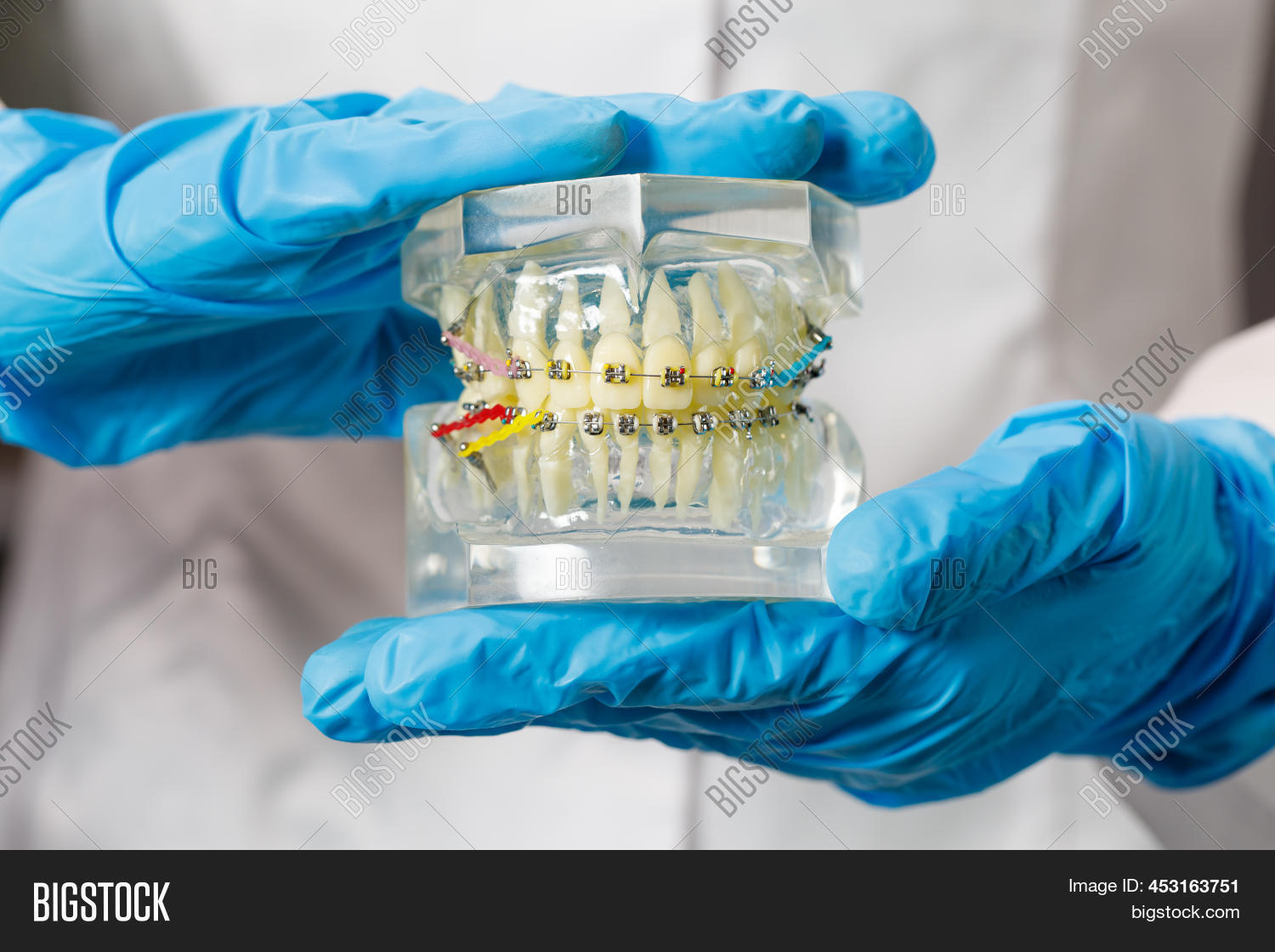 Mould Human Teeth Image & Photo (Free Trial) | Bigstock