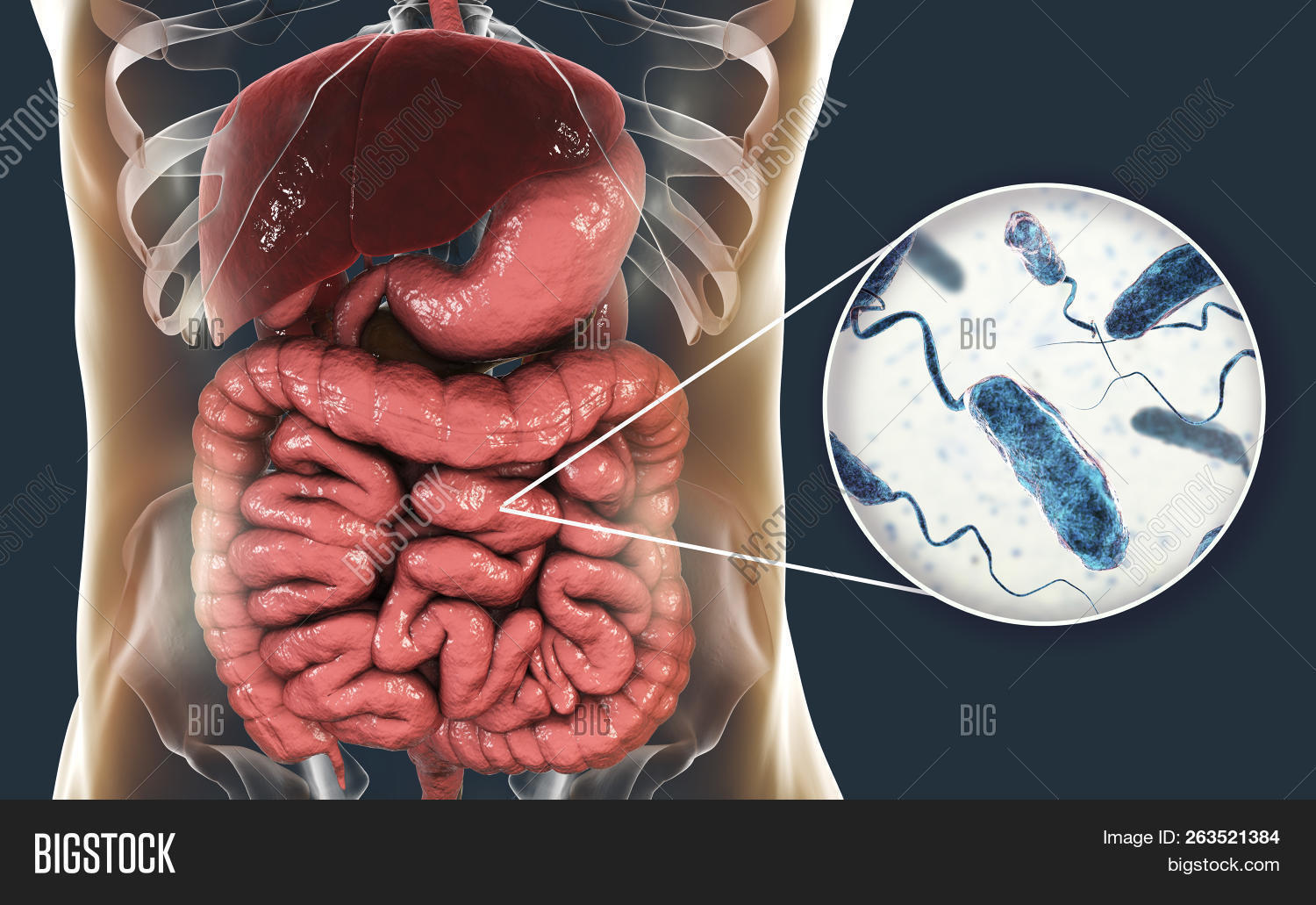 Vibrio Cholerae Image & Photo (Free Trial) | Bigstock