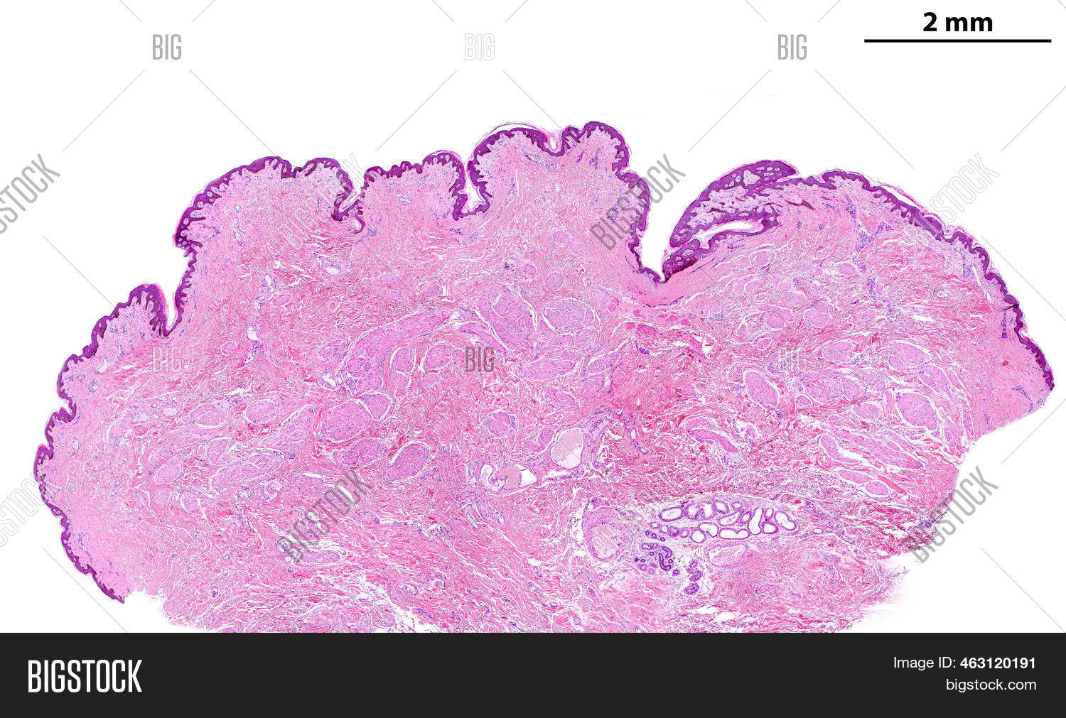 Low Power Light Image & Photo (Free Trial) | Bigstock