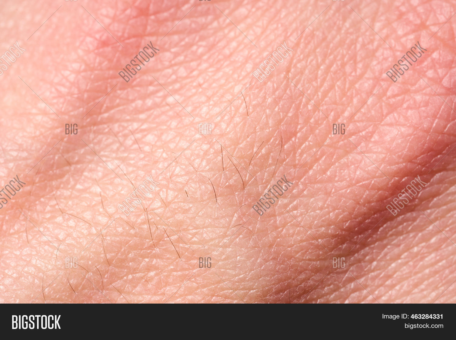 Background Pink Skin Image & Photo (Free Trial) | Bigstock