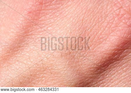 Background Pink Skin Image & Photo (Free Trial) | Bigstock