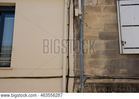 Before After Facelift Image & Photo (Free Trial) | Bigstock