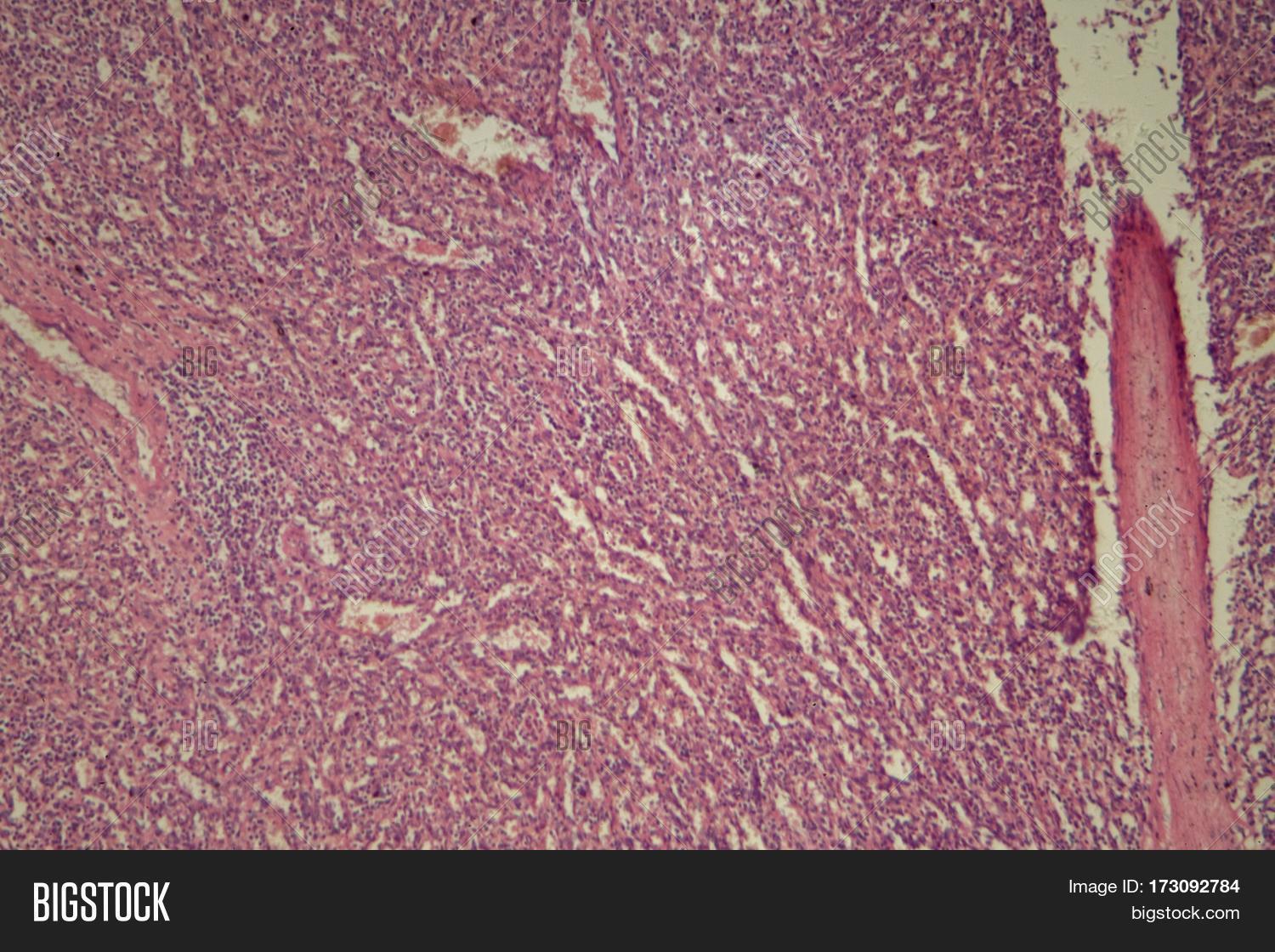 Cells Human Spleen Image & Photo (Free Trial) | Bigstock