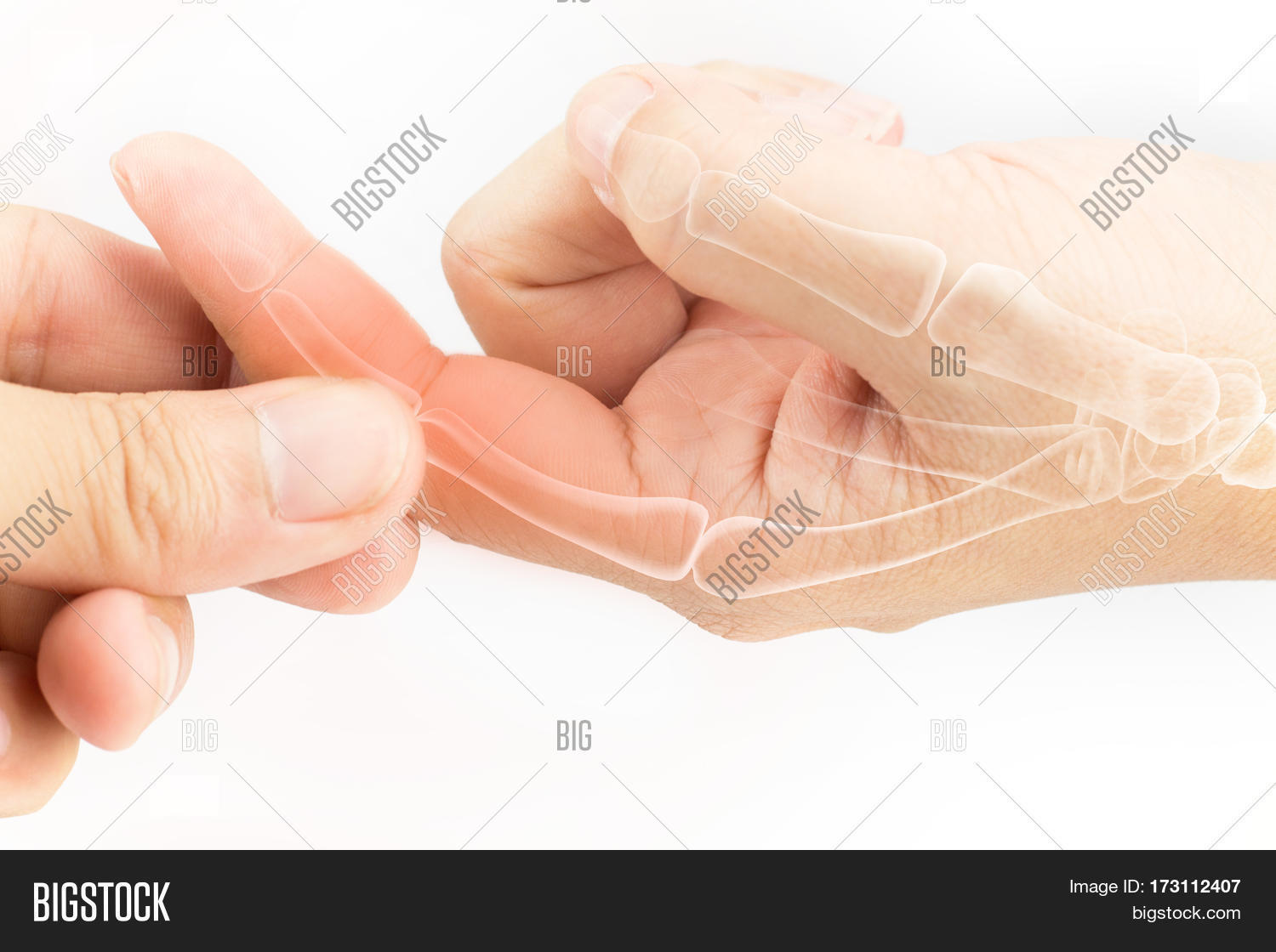 Finger Bone Pain White Image & Photo (Free Trial) | Bigstock