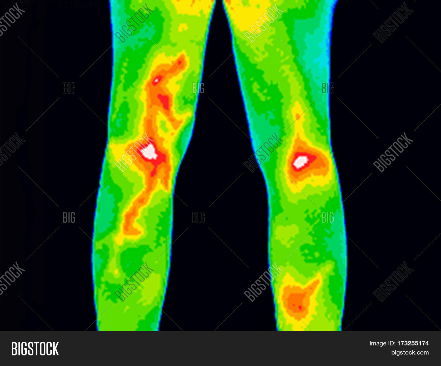 Thermographic Image Image & Photo (Free Trial) | Bigstock