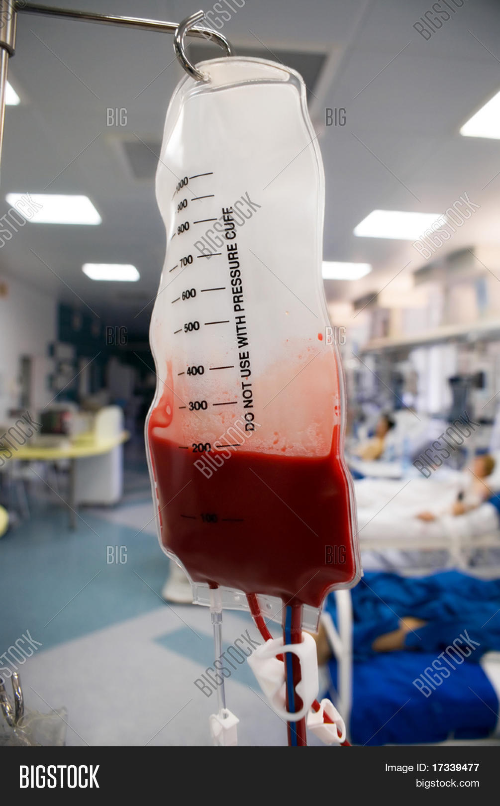 Blood Transfusion Image & Photo (Free Trial) | Bigstock