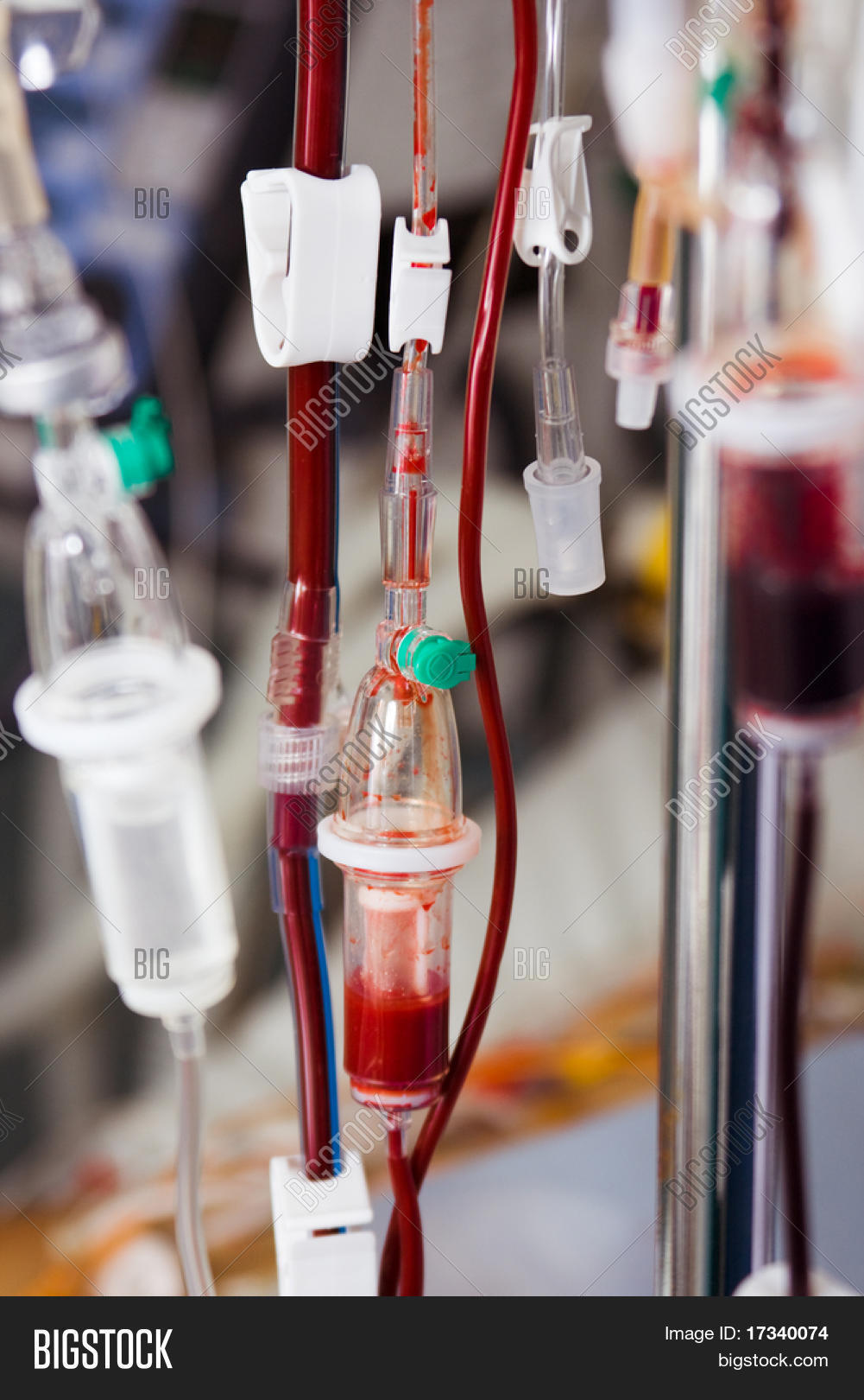 Blood Reinfusion Image & Photo (Free Trial) | Bigstock