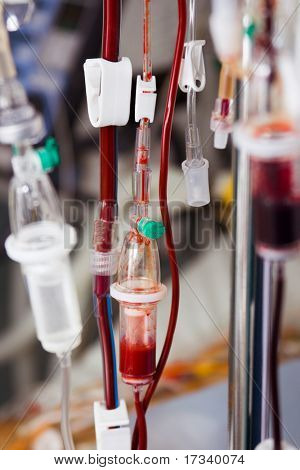 Blood Reinfusion Image & Photo (Free Trial) | Bigstock