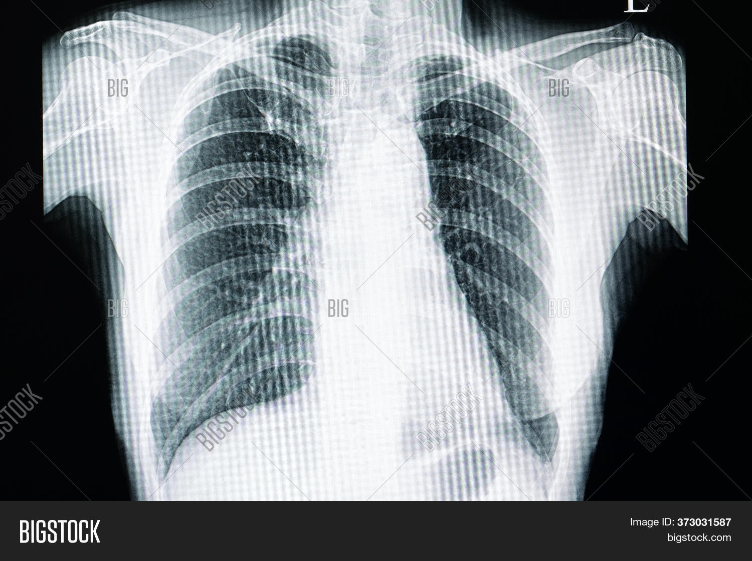 Xray Film Patient Image & Photo (Free Trial) | Bigstock