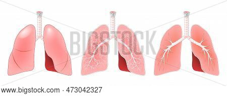 Lungs Anatomy. Cross Vector & Photo (Free Trial) | Bigstock