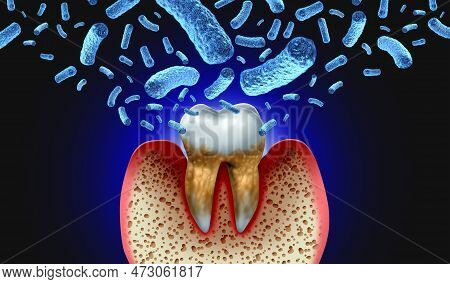Bacterial Tooth Image & Photo (Free Trial) | Bigstock