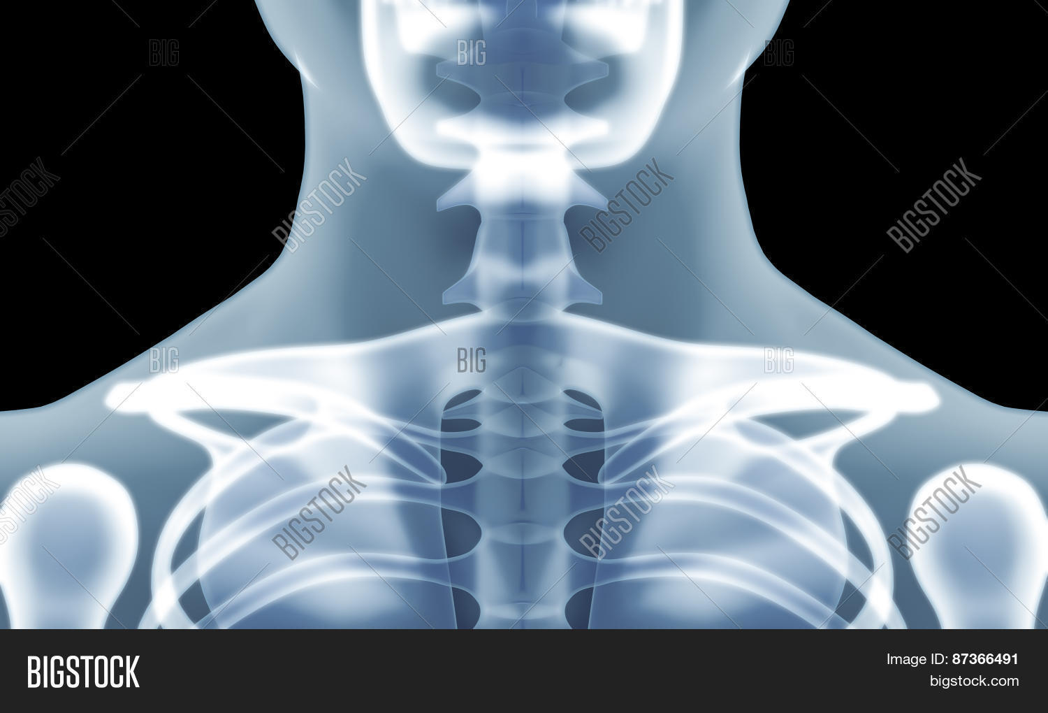 Human Skeleton Chest X Image & Photo (Free Trial) | Bigstock