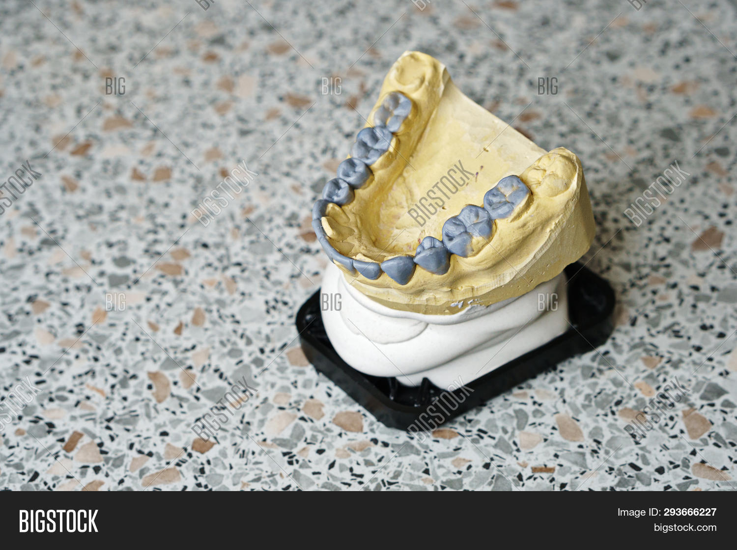 Dental Impressions Image & Photo (Free Trial) | Bigstock