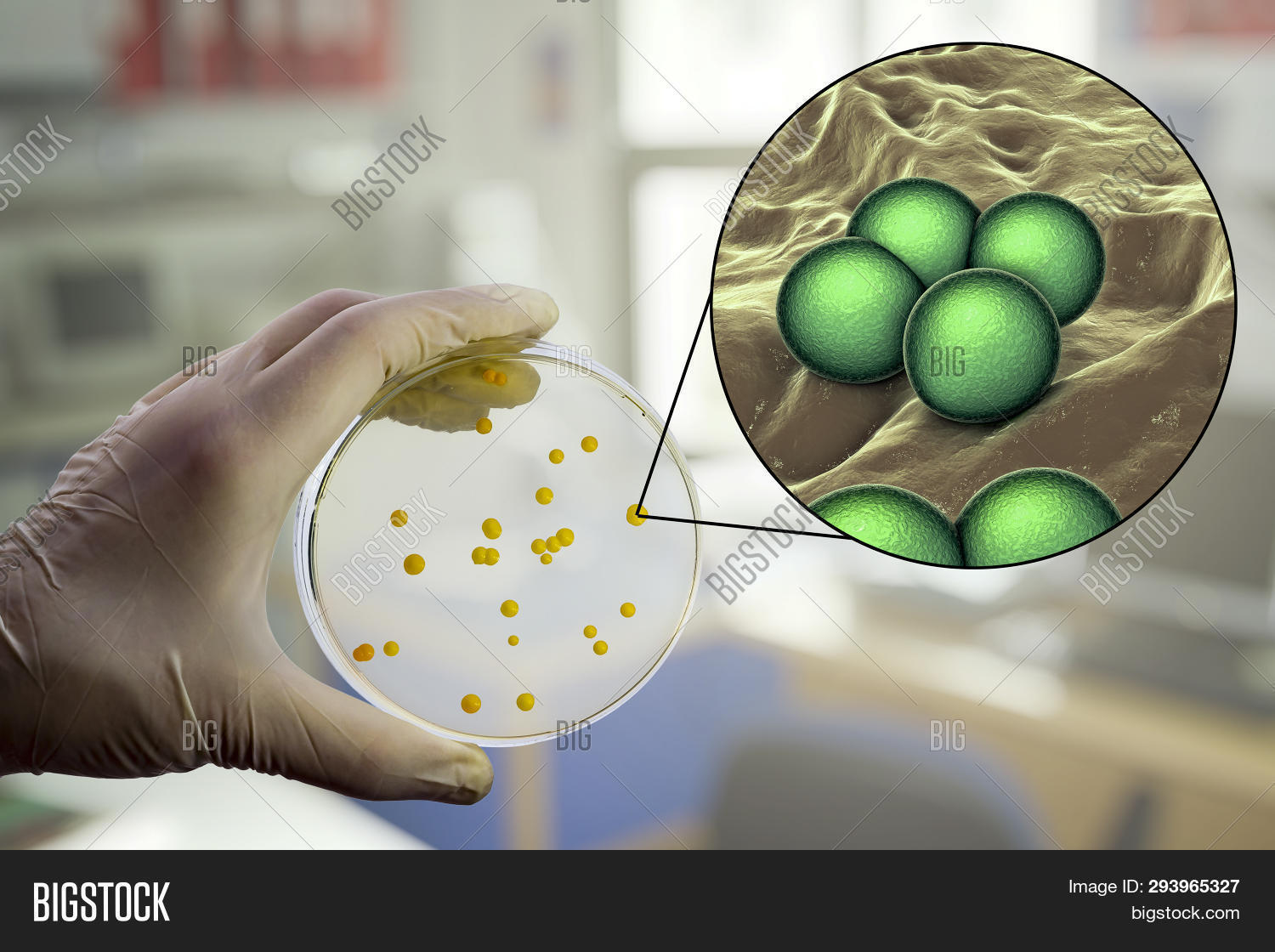 Colonies Micrococcus Image & Photo (Free Trial) | Bigstock