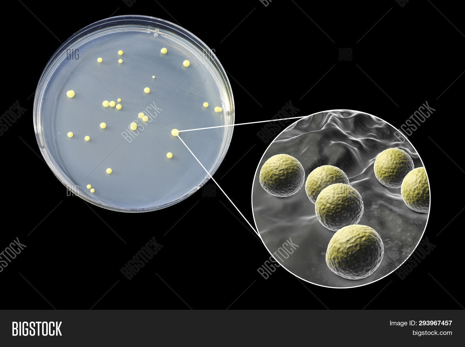 Colonies Micrococcus Image & Photo (Free Trial) | Bigstock