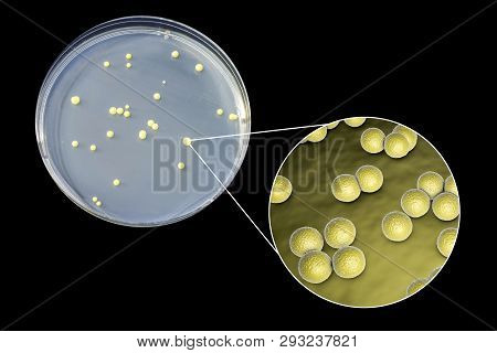 Colonies Micrococcus Image & Photo (Free Trial) | Bigstock