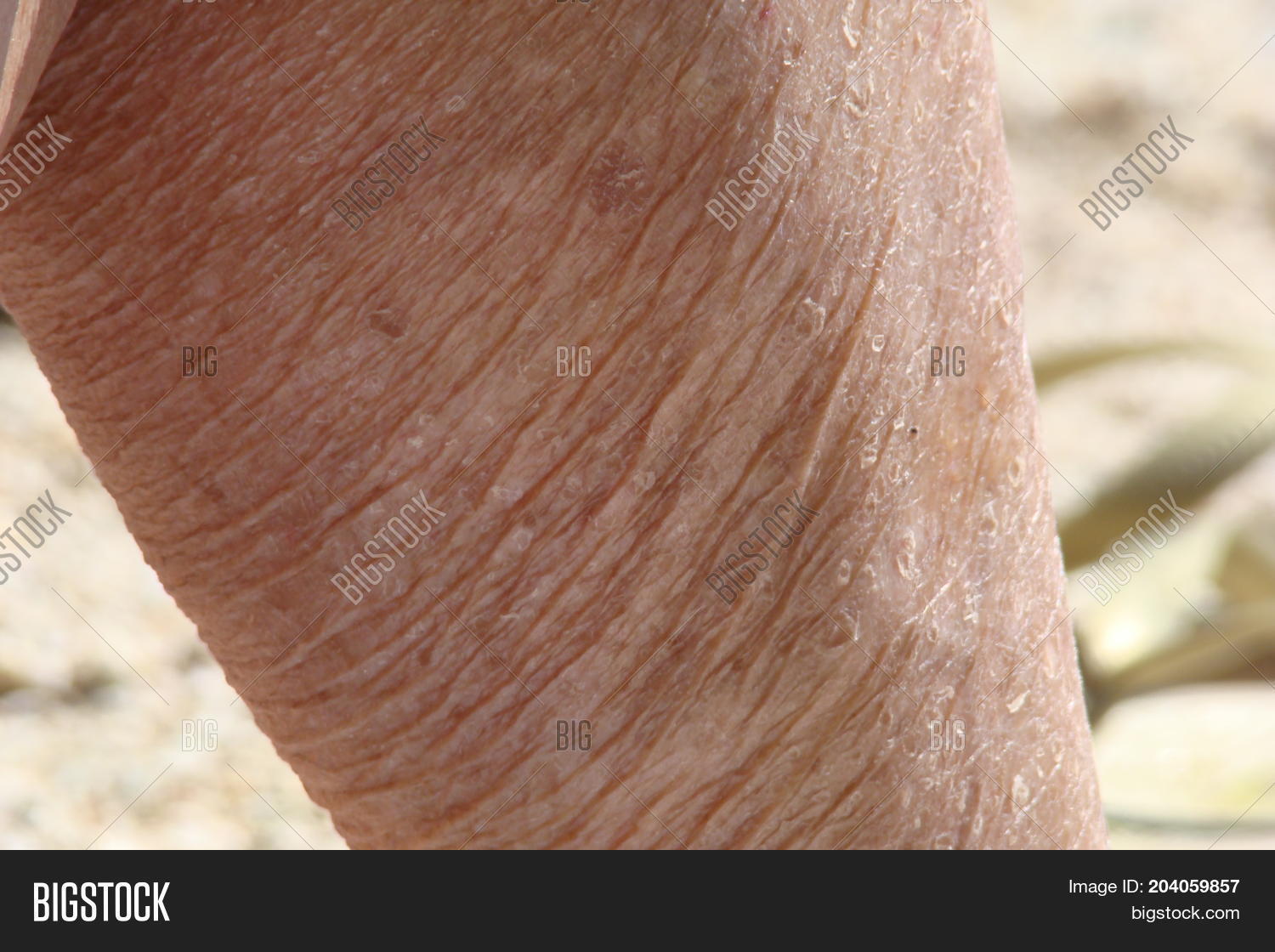 Human Aging Sagging Image & Photo (Free Trial) | Bigstock