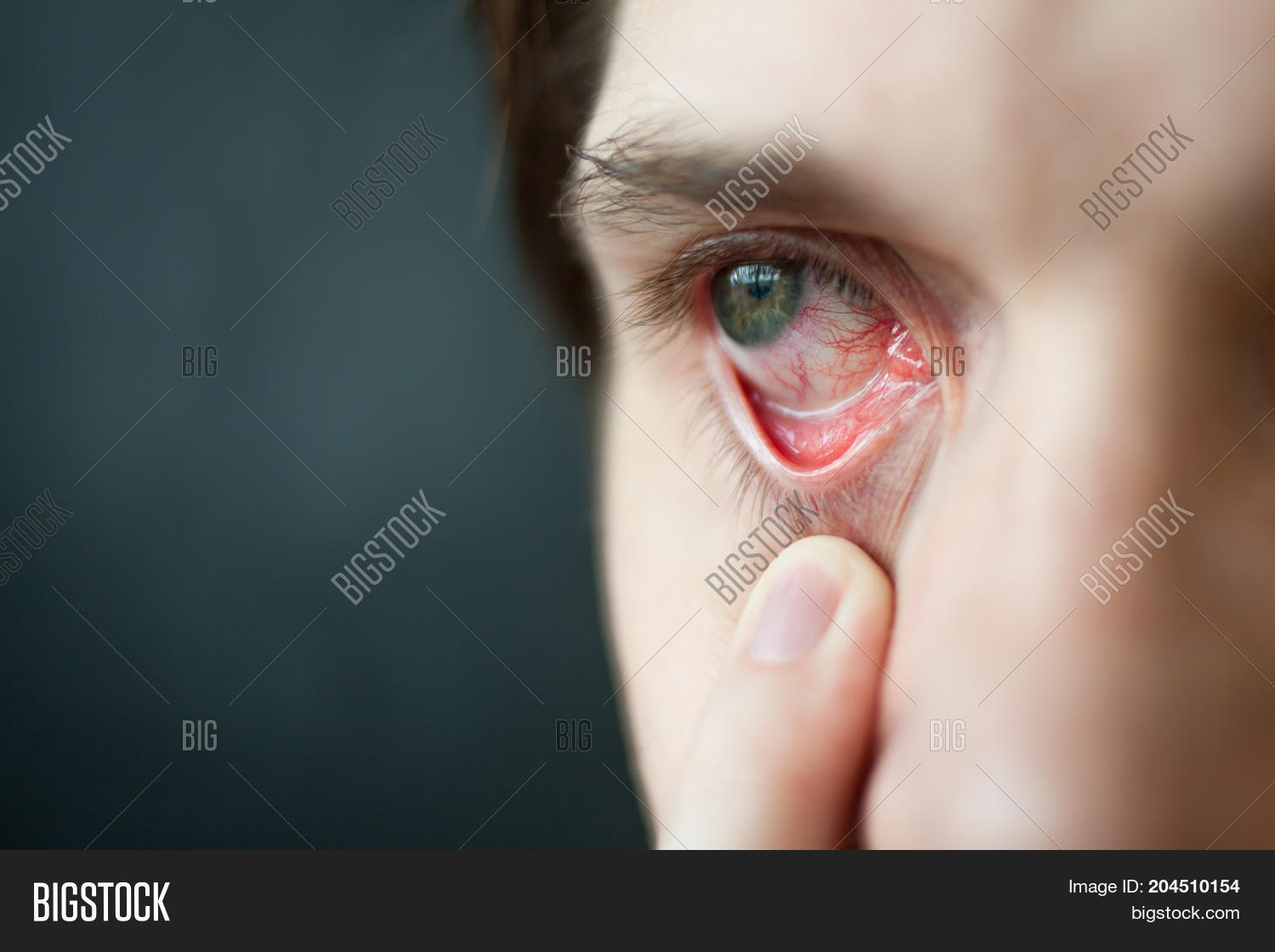Mens Red Eye Close-, Image & Photo (Free Trial) | Bigstock