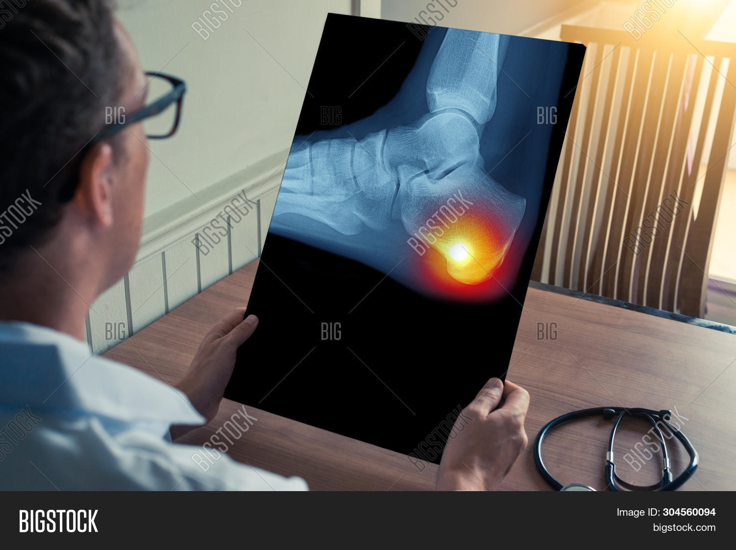 Doctor Holding X-ray Image & Photo (Free Trial) | Bigstock