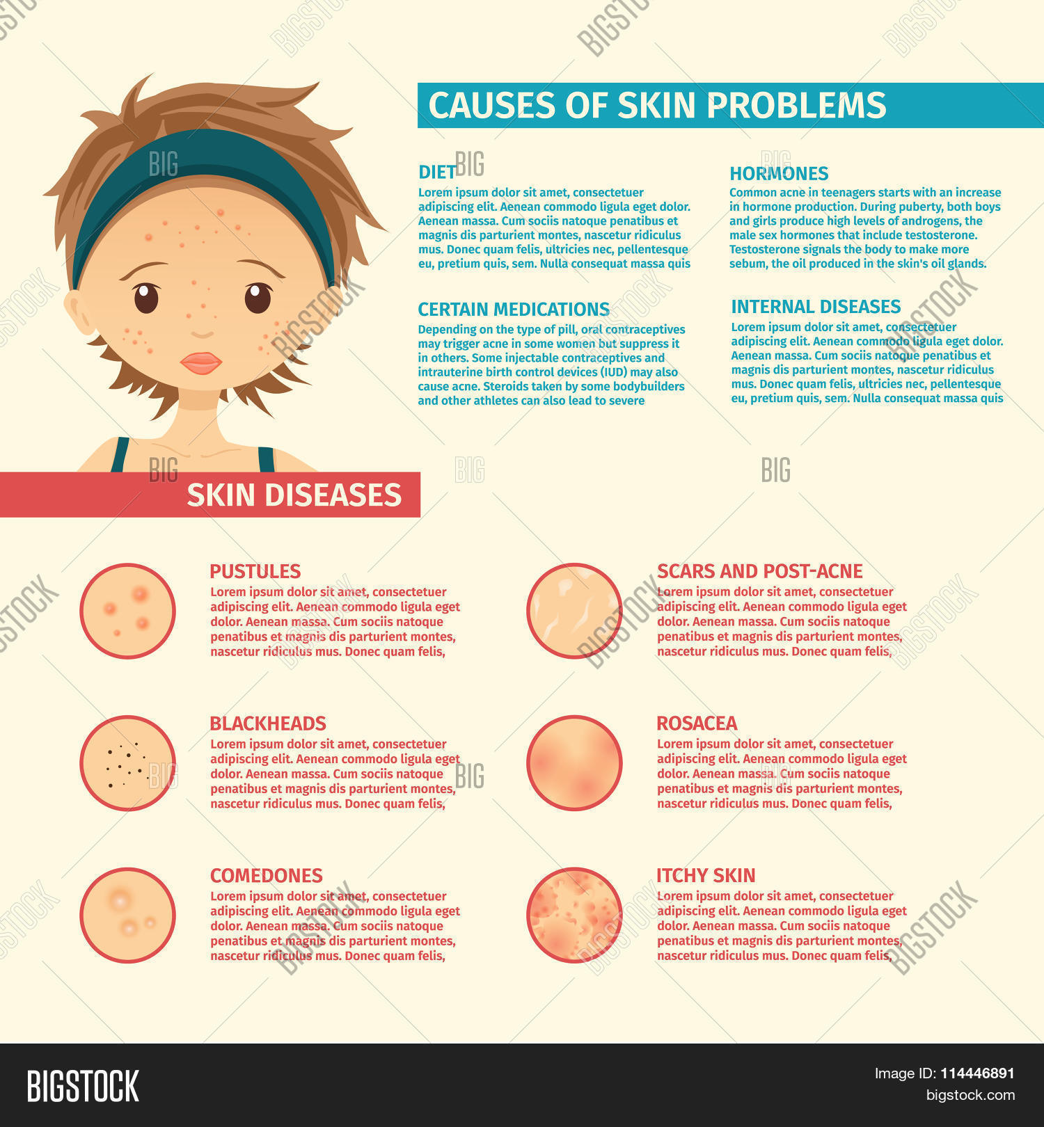 Infographics Skin Vector & Photo (Free Trial) | Bigstock